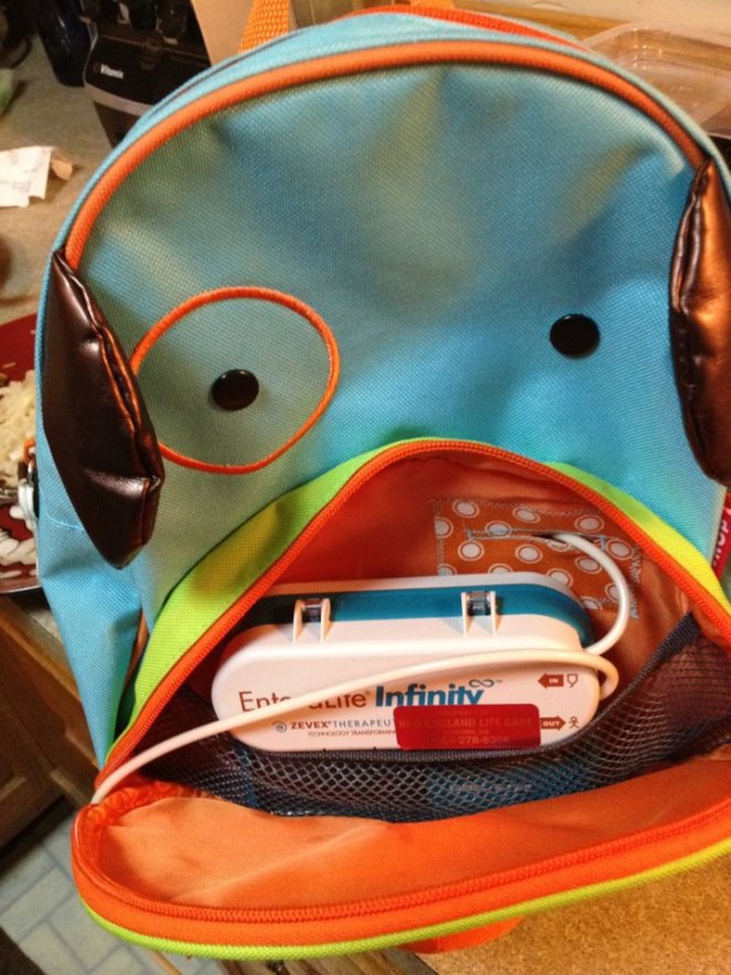 Feeding Pump Backpack Conversion – Keikikai